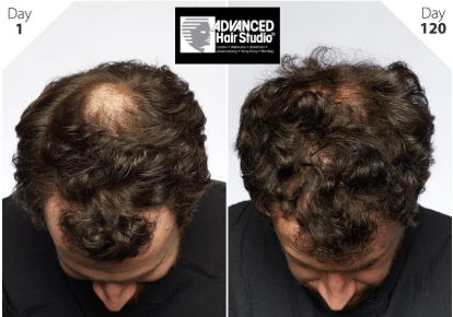 Home - Advanced Hair Studio Shop