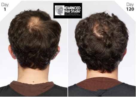 Home - Advanced Hair Studio Shop