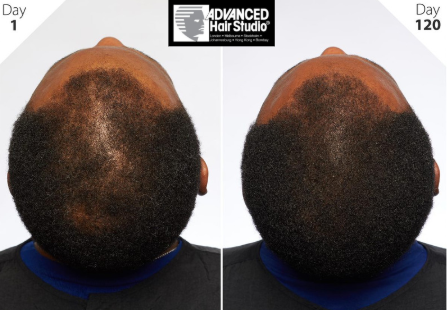 Home - Advanced Hair Studio Shop